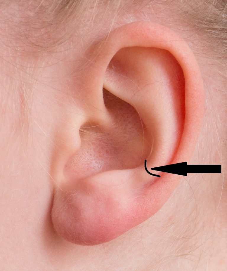 Best Cartilage Earrings Guide (With Images) | Jewelry Guide